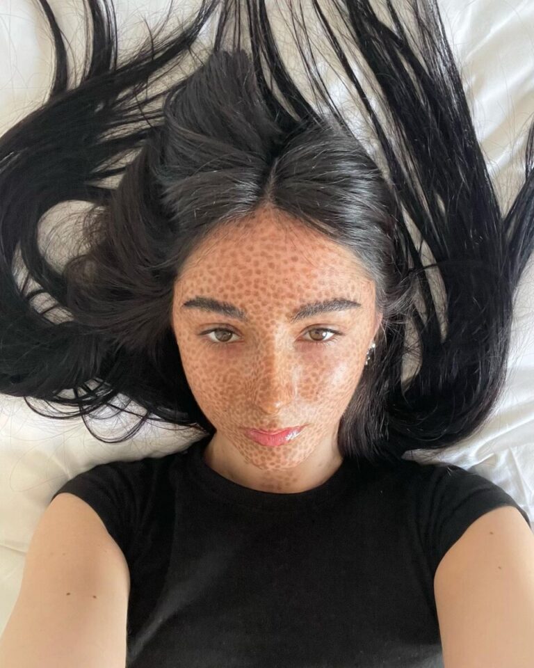 La modelo española que resalta por sus pecas y desafía los estereotipos ...