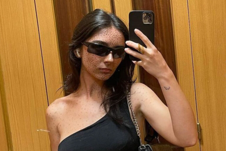 La modelo española que resalta por sus pecas y desafía los estereotipos ...